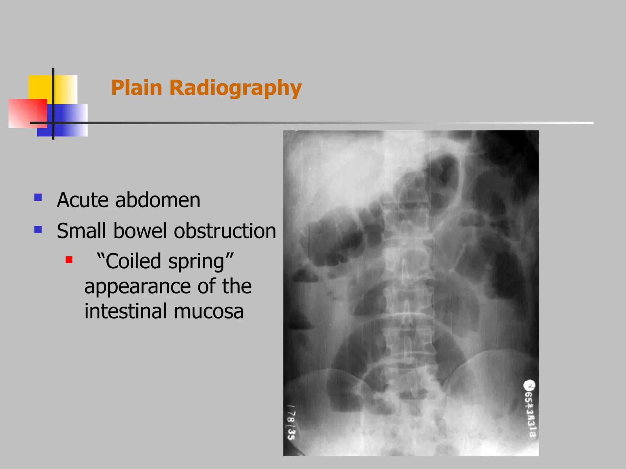 Radiology of digestive system | PPT
