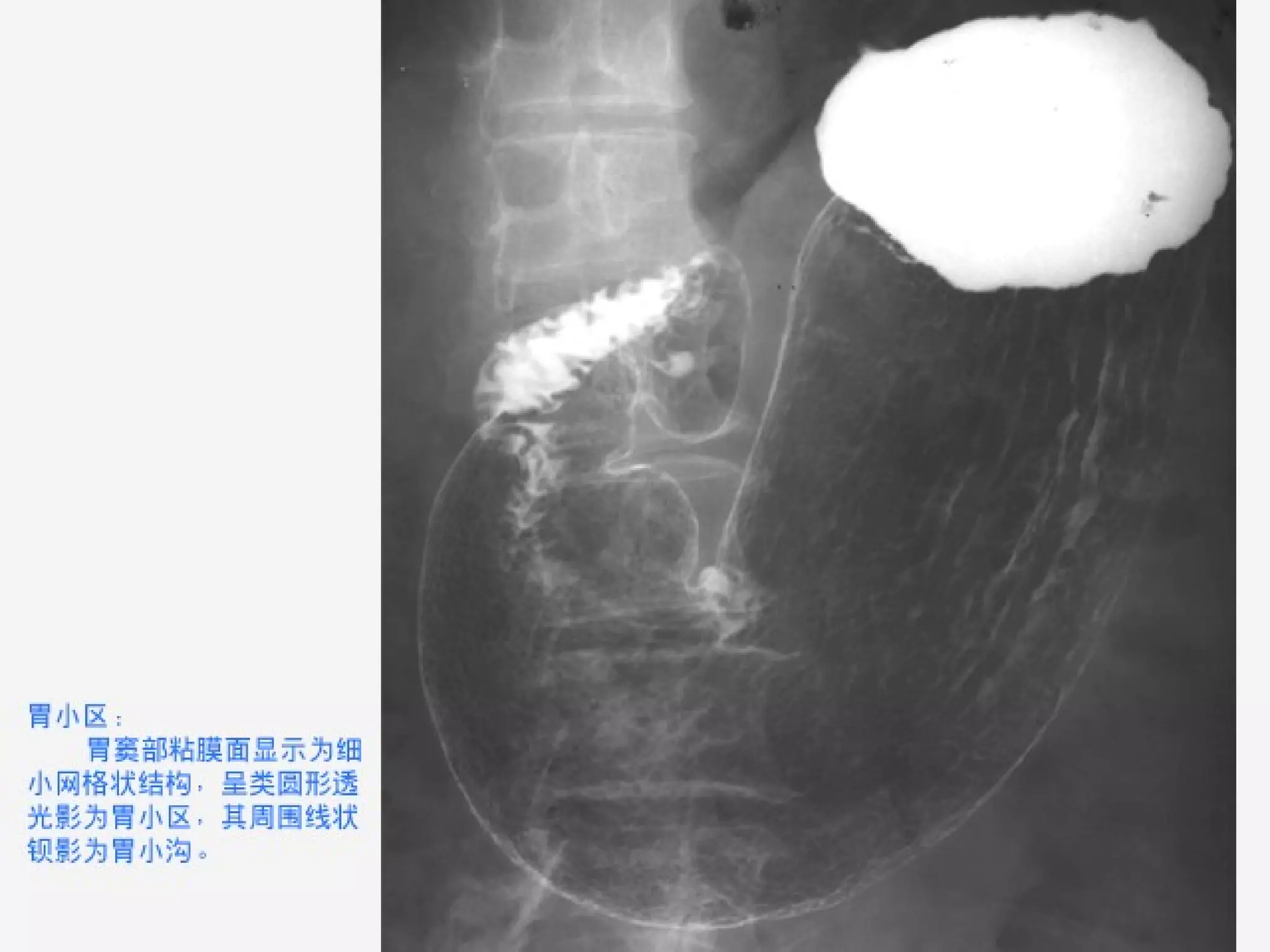 Radiology of digestive system | PPT