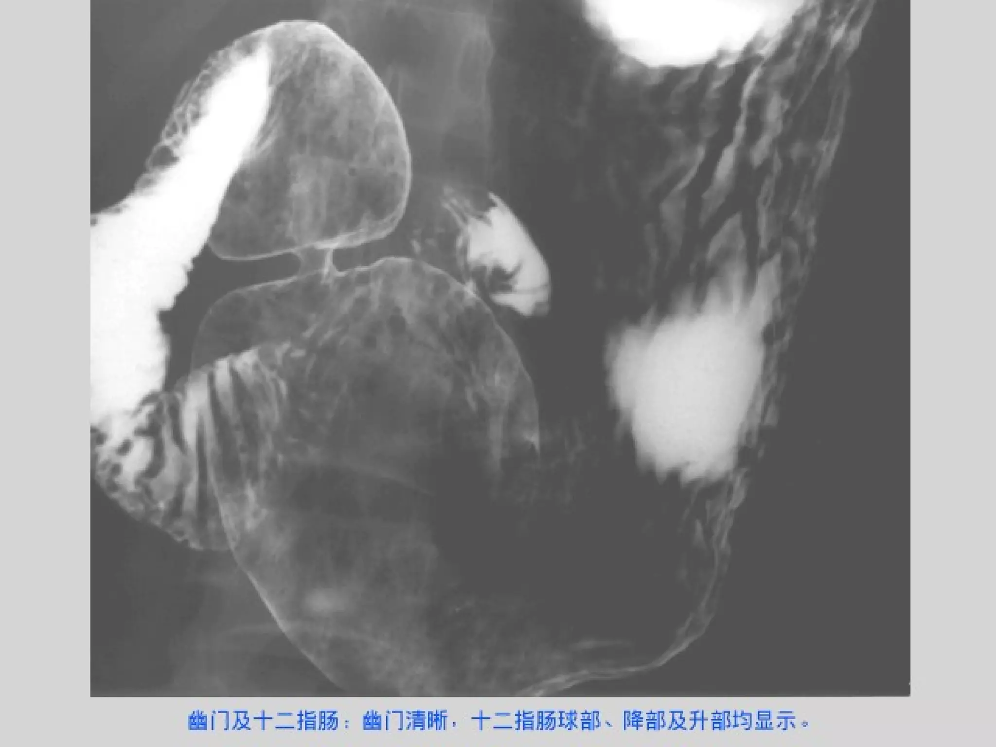 Radiology of digestive system | PPT