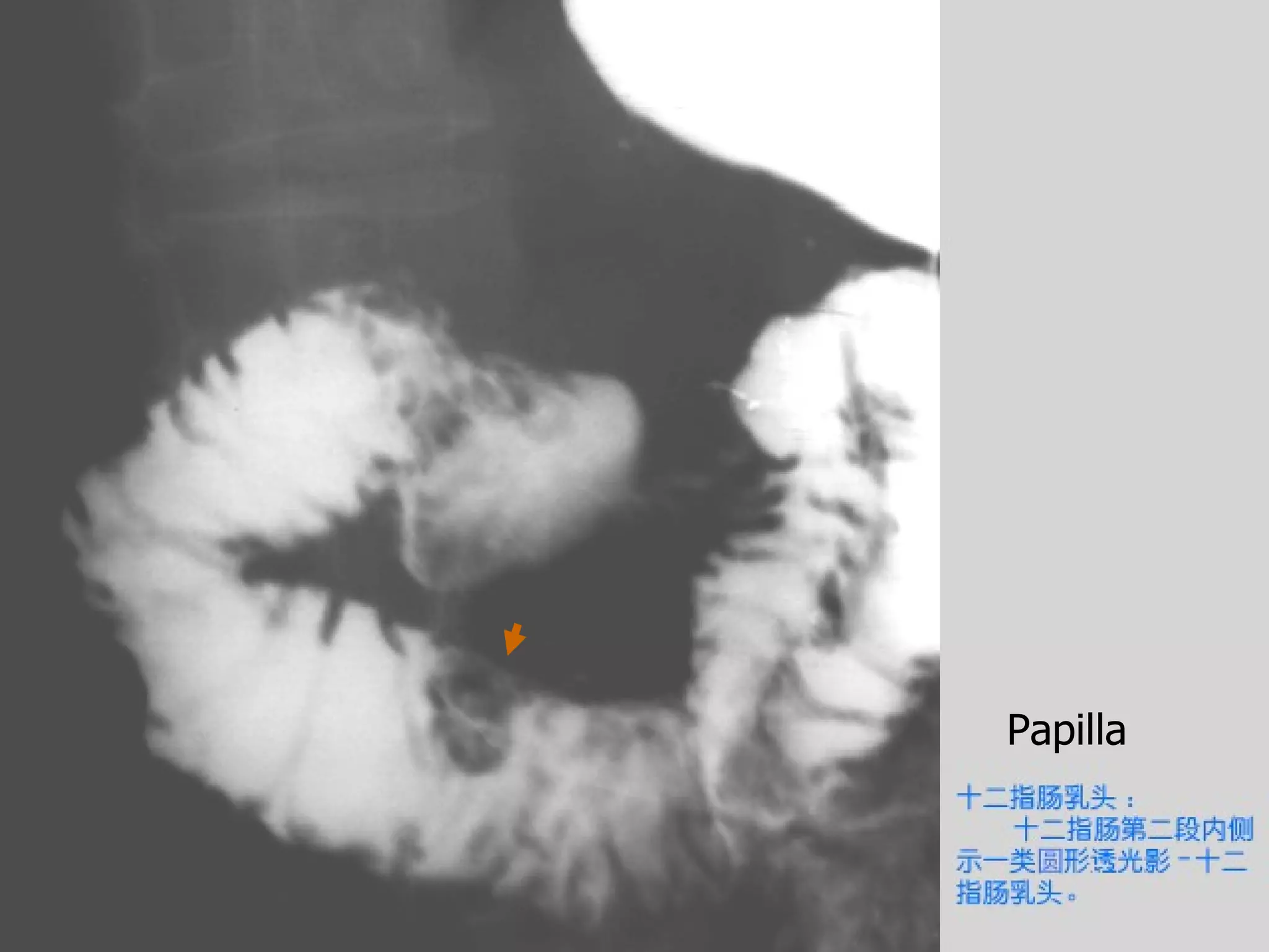 Radiology of digestive system | PPT