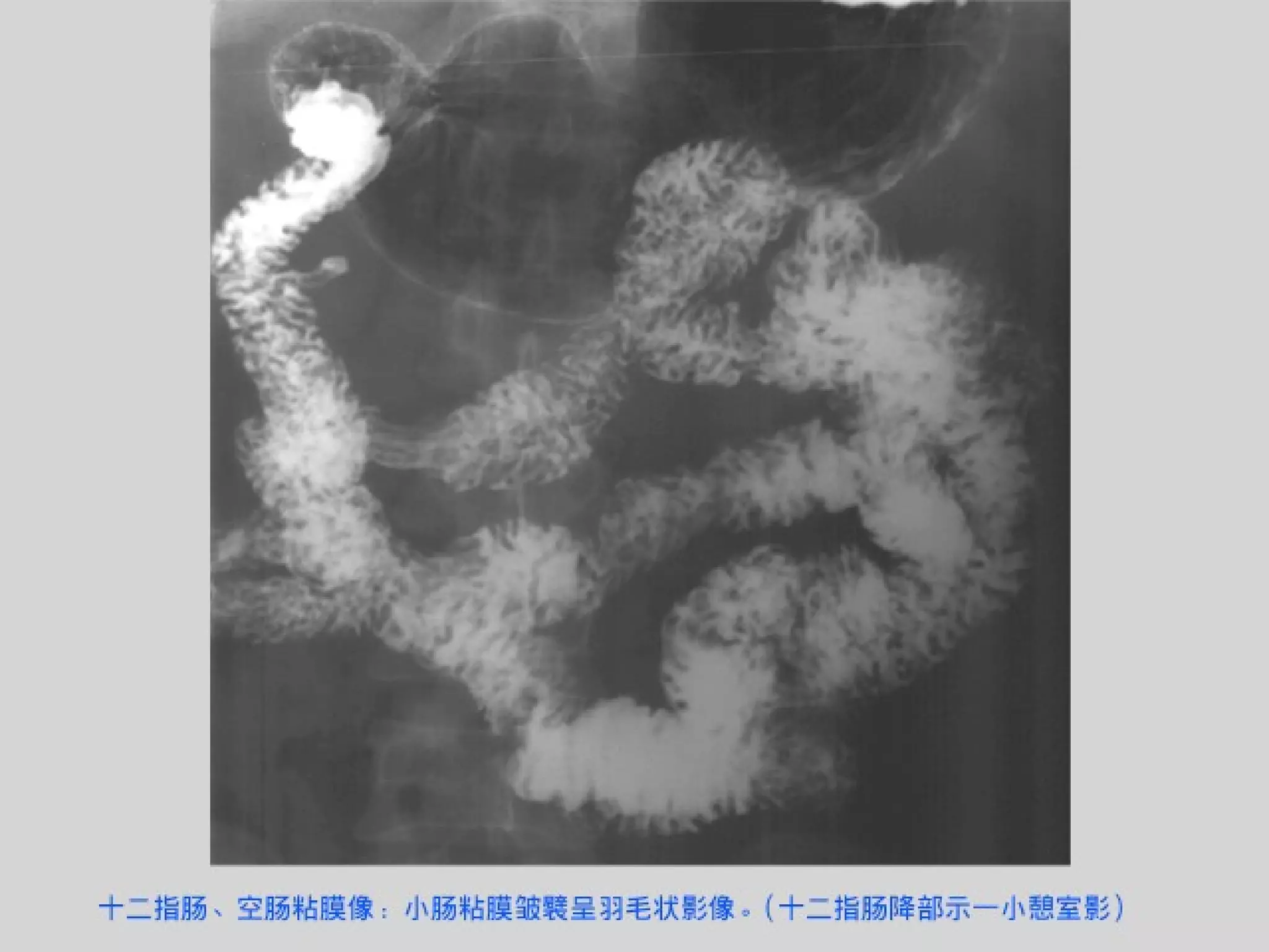 Radiology of digestive system | PPT