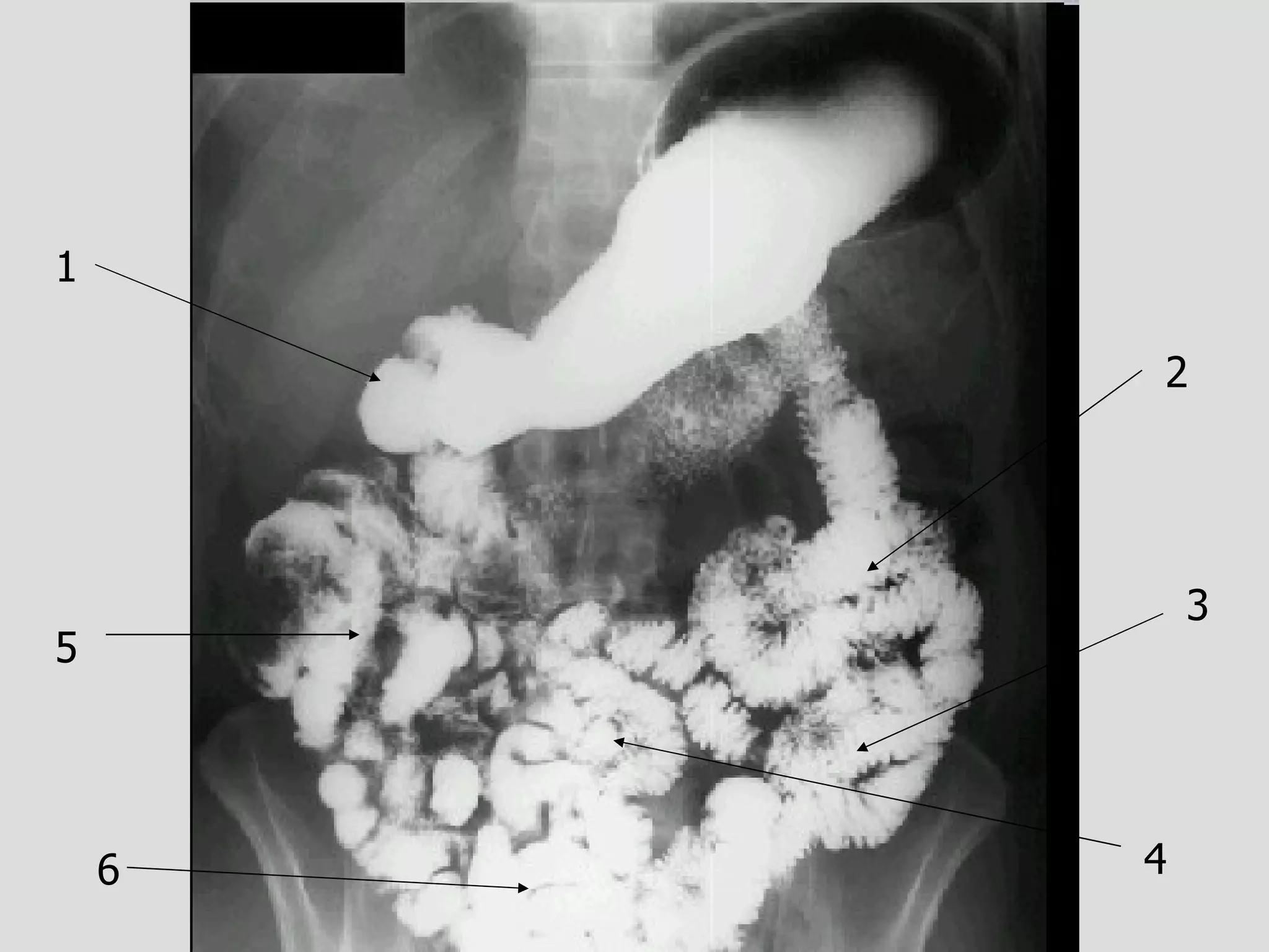 Radiology of digestive system | PPT