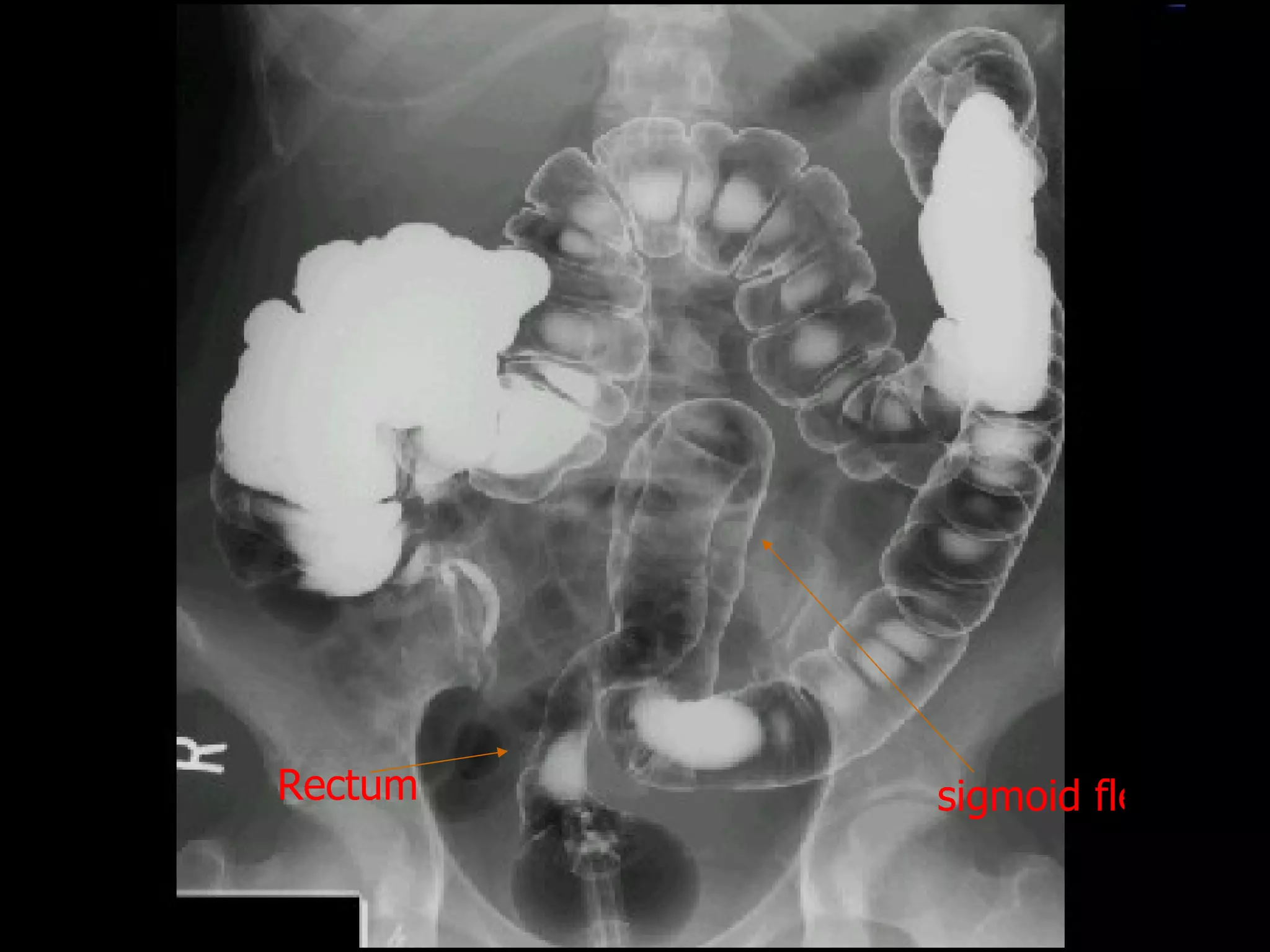 Radiology of digestive system | PPT