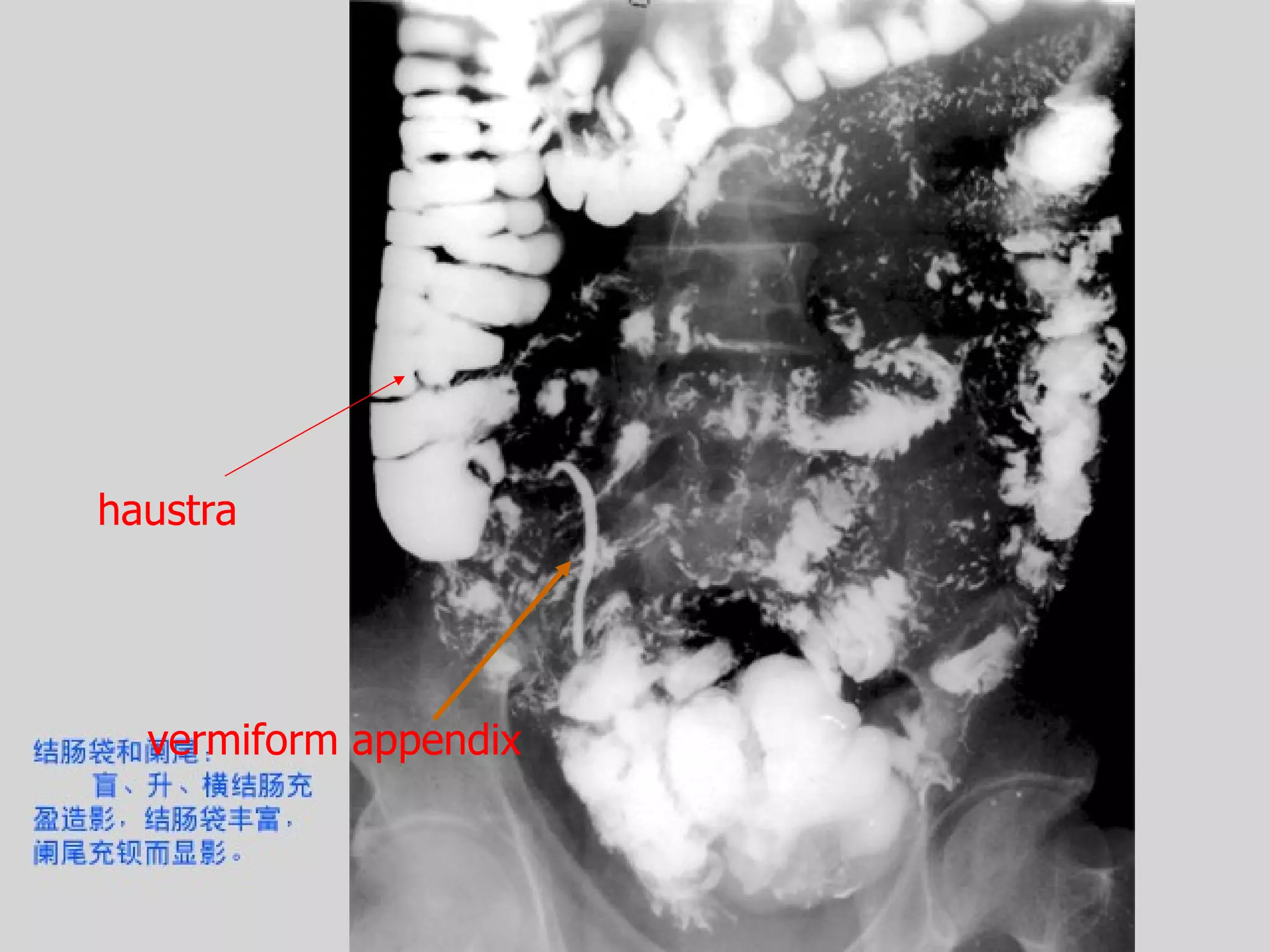 Radiology of digestive system | PPT
