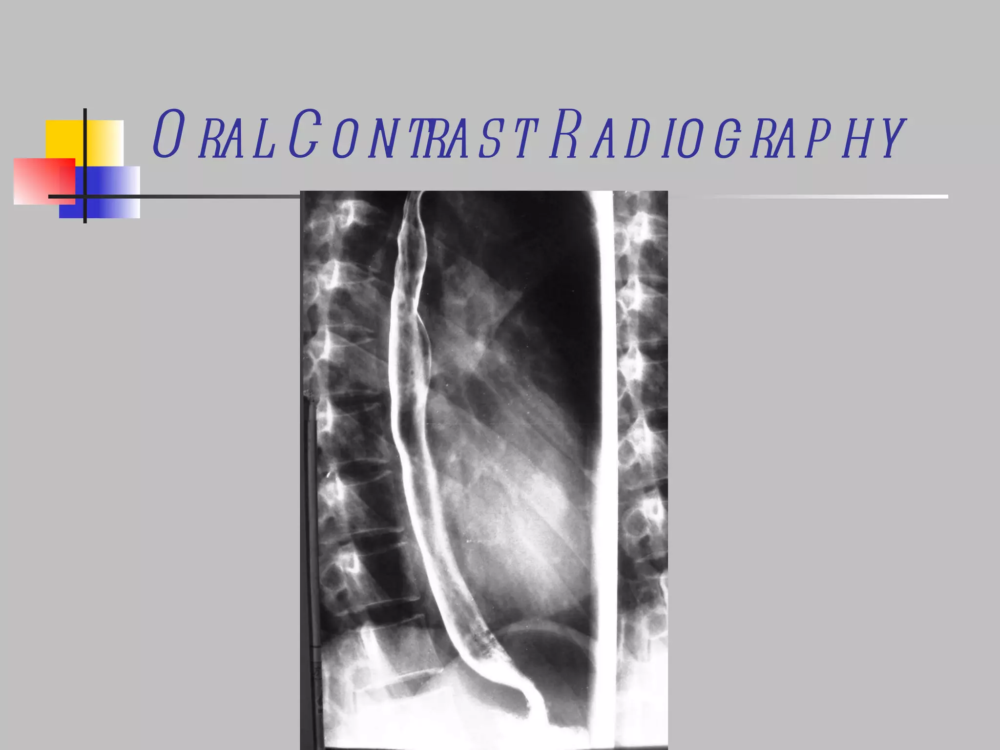 Radiology of digestive system | PPT