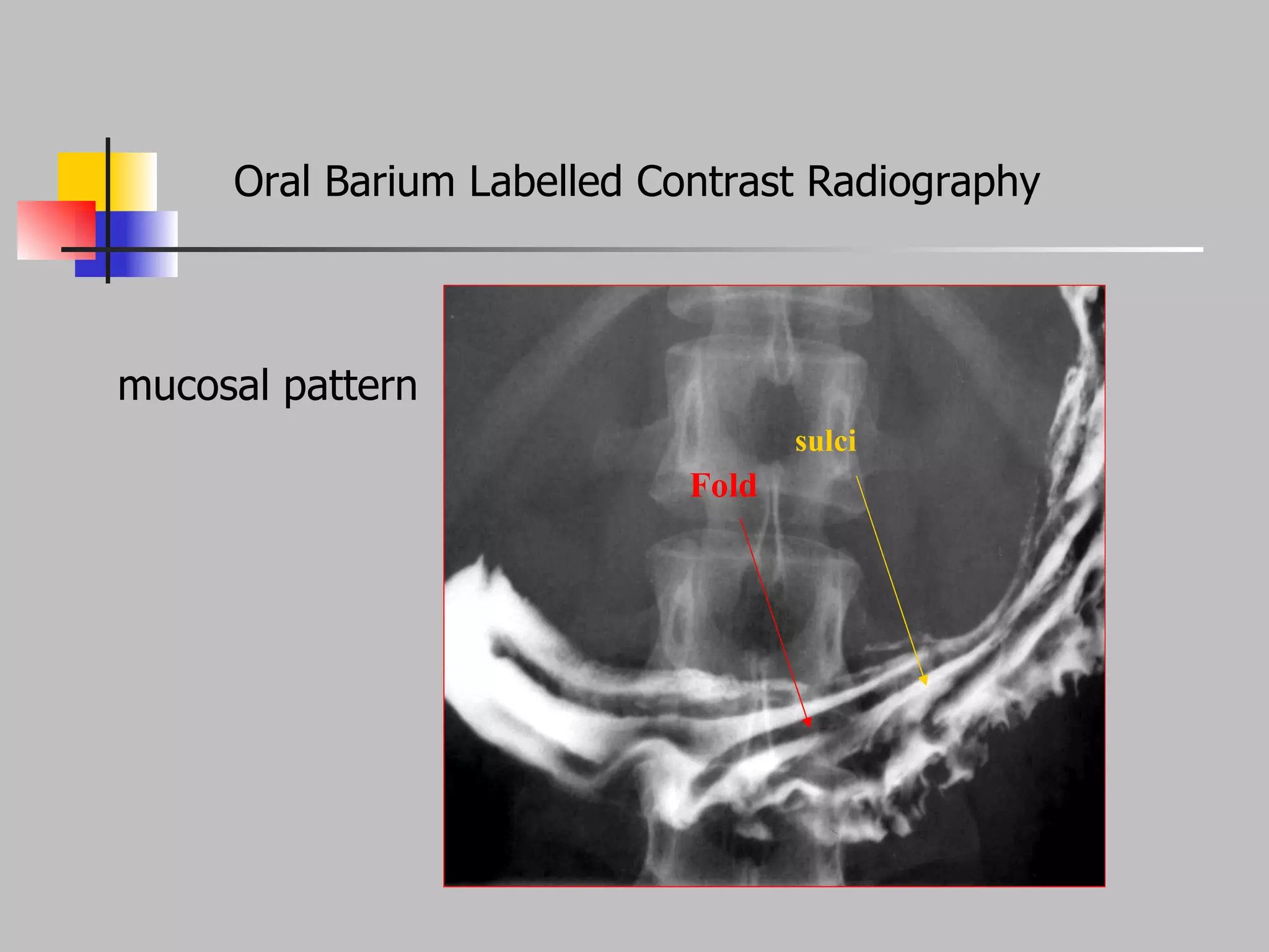 Radiology of digestive system | PPT