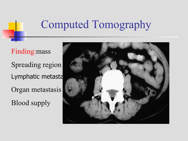 Radiology of digestive system | PPT | Digestive Disorders | Diseases ...