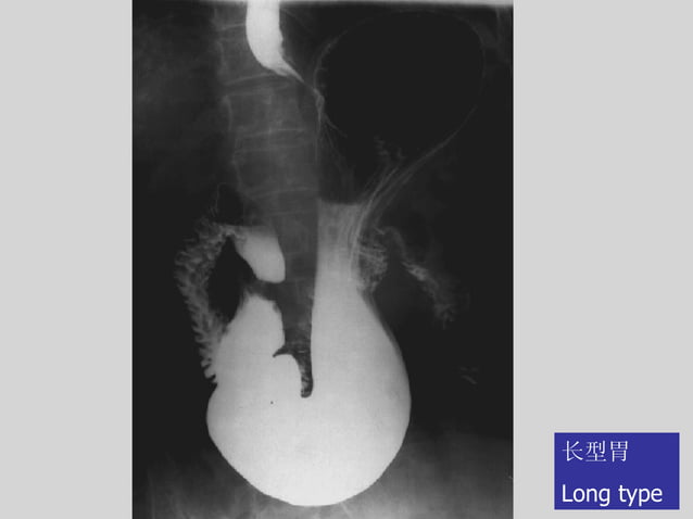Radiology of digestive system | PPT | Digestive Disorders | Diseases ...