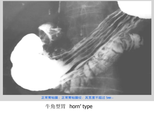 Radiology of digestive system | PPT | Digestive Disorders | Diseases ...