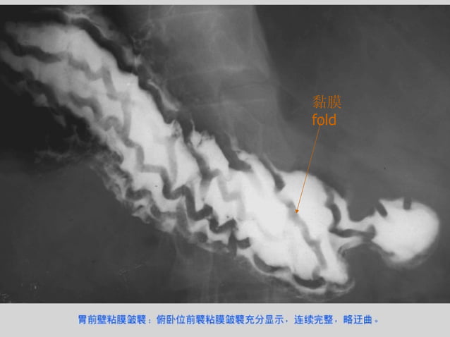 Radiology of digestive system | PPT | Digestive Disorders | Diseases ...