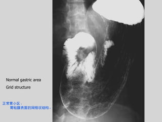 Radiology of digestive system | PPT