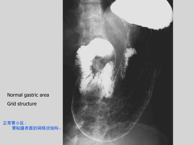 Radiology of digestive system | PPT | Digestive Disorders | Diseases ...