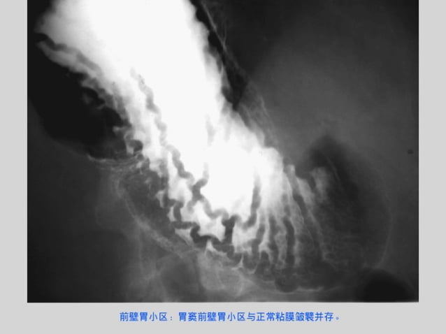 Radiology of digestive system | PPT | Digestive Disorders | Diseases ...