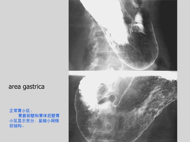 Radiology of digestive system | PPT | Digestive Disorders | Diseases ...