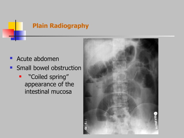 Radiology of digestive system | PPT | Digestive Disorders | Diseases ...