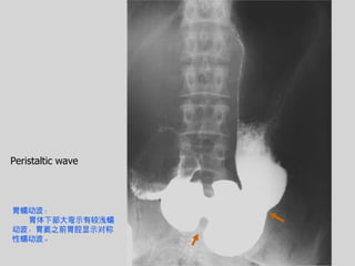 Radiology of digestive system | PPT