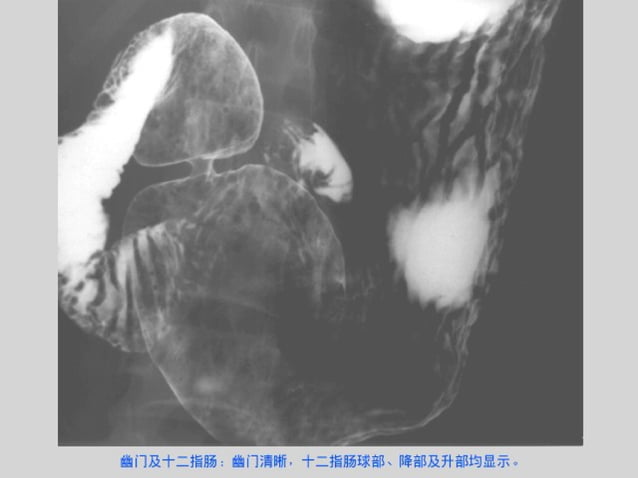 Radiology of digestive system | PPT | Digestive Disorders | Diseases ...