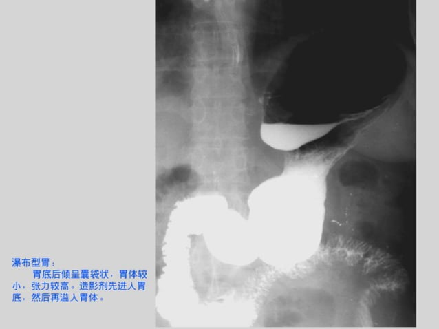 Radiology of digestive system | PPT | Digestive Disorders | Diseases ...