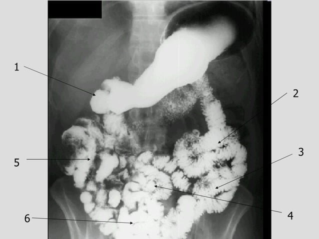 Radiology of digestive system | PPT | Digestive Disorders | Diseases ...