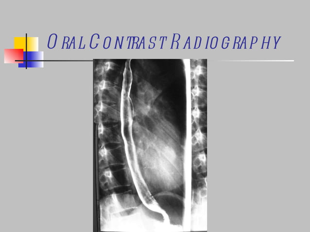 Radiology of digestive system | PPT | Digestive Disorders | Diseases ...