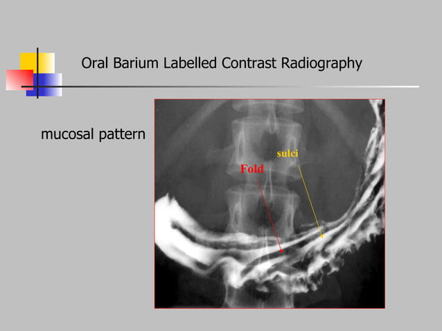 Radiology of digestive system | PPT | Digestive Disorders | Diseases ...