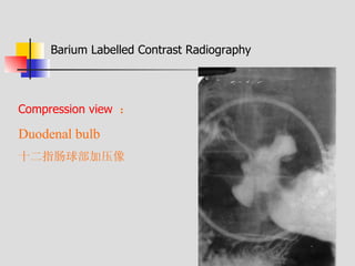 Radiology of digestive system | PPT