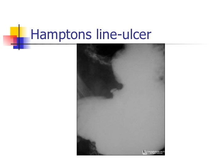 Radiology of digestive system