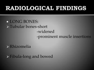 RADIOLOGY OF DWARFISM.pptx