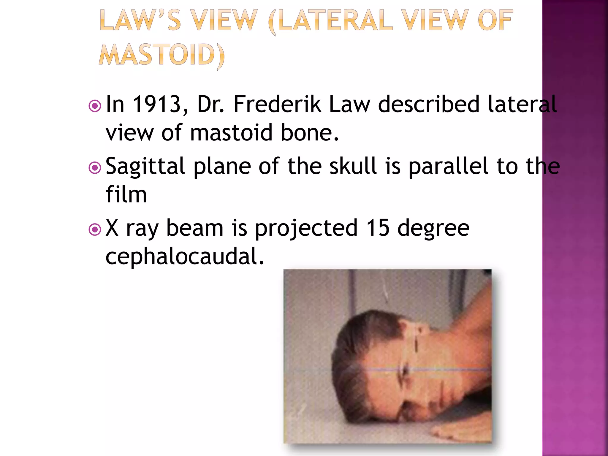 Radiology of ear - DR. ROHIT BHARDWAJ.pptx