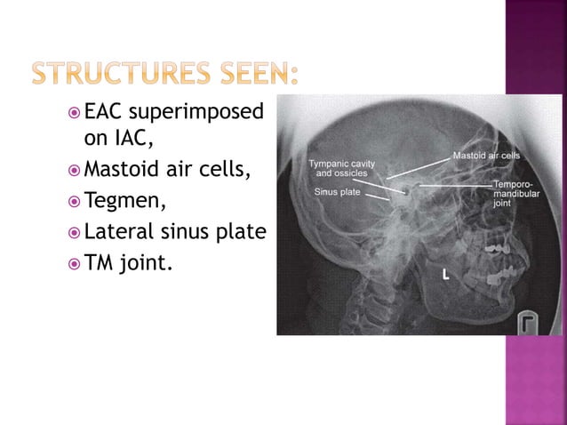 Radiology of ear - DR. ROHIT BHARDWAJ.pptx