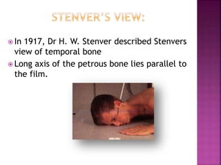 Radiology of ear - DR. ROHIT BHARDWAJ.pptx