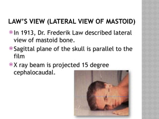 radiologyofear-dr-220804152916-61c9805f (1).pptx