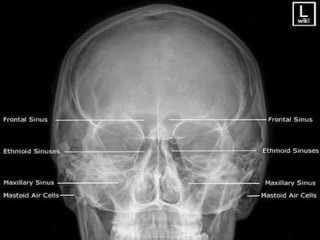 RADIOLOGY OF HEAD and NECK -Anatomy.pptx