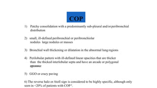 RADIOLOGY OF ILD.pptx