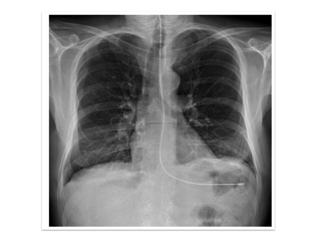RADIOLOGY OF LINES AND TUBES IN INTENSIVE CARE SEMINAR.pdf
