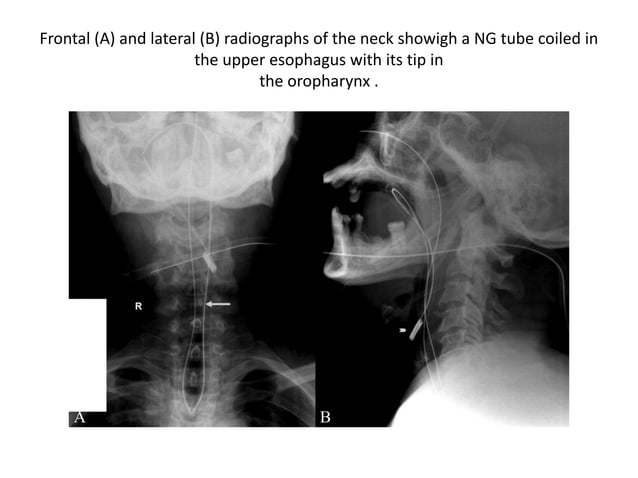 RADIOLOGY OF LINES AND TUBES IN INTENSIVE CARE SEMINAR.pdf
