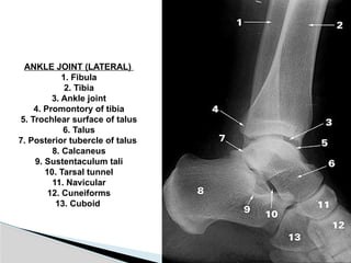 RADIOLOGY OF LOWER LIMB - Anatomy .pptx