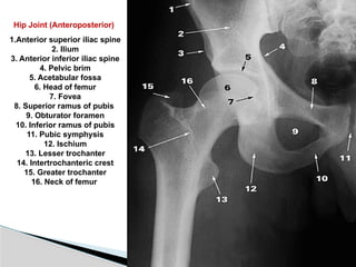 RADIOLOGY OF LOWER LIMB - Anatomy .pptx