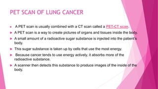RADIOLOGY OF LUNG CANCER.pptx