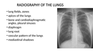 Radiology of lung diseases in full detail | PPTX