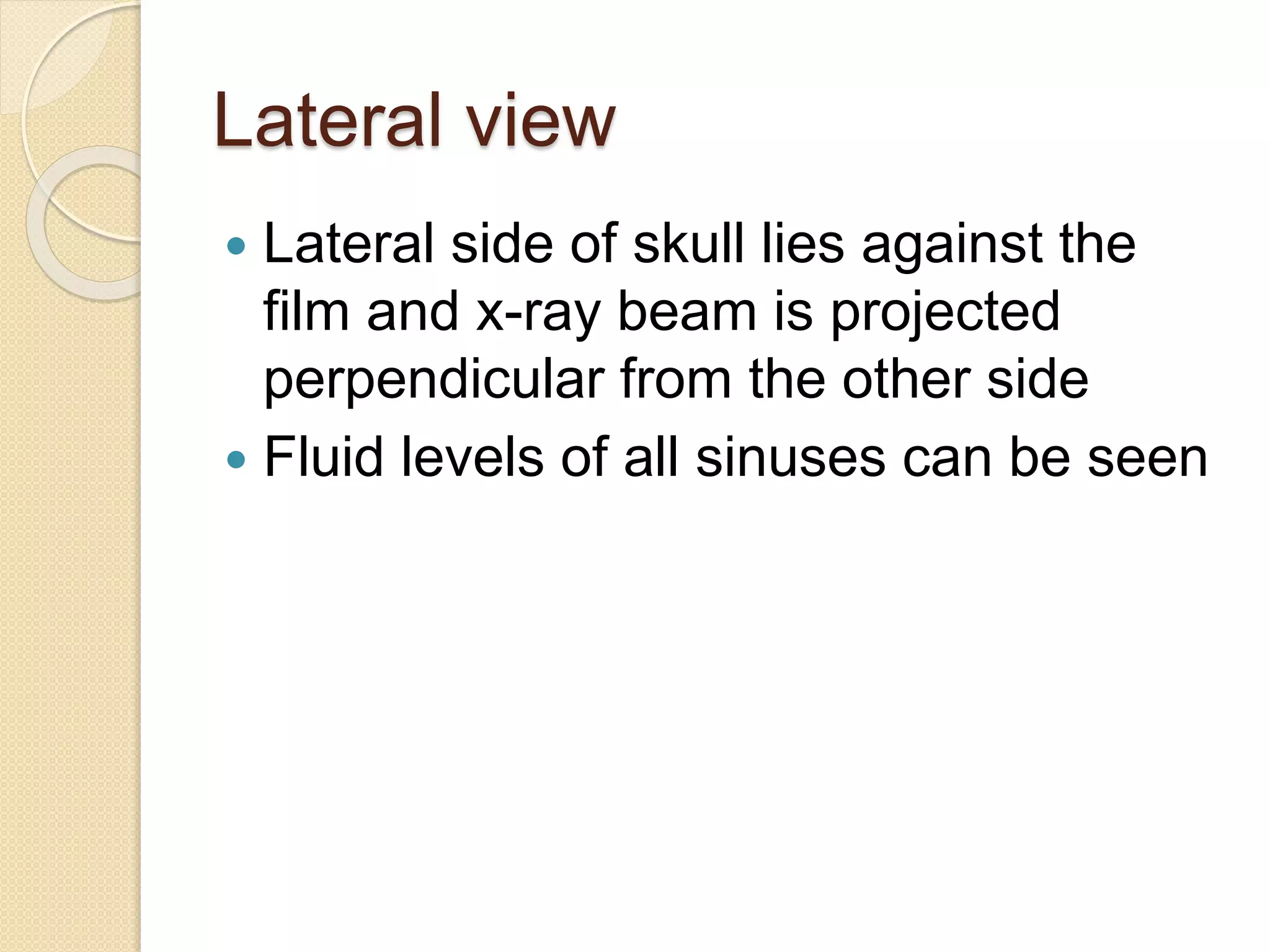 Radiology of nose and paranasal sinuses | PPTX