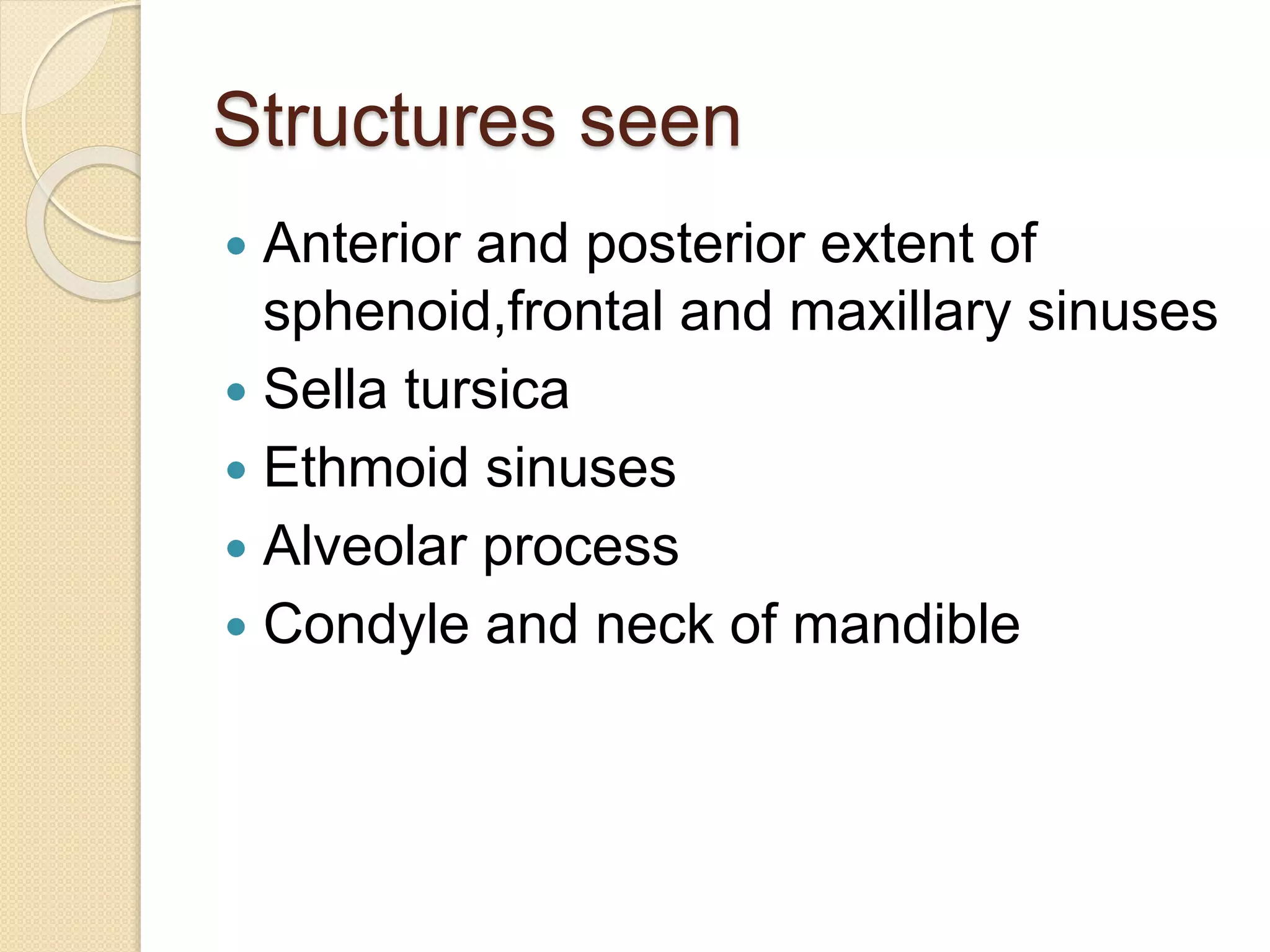 Radiology of nose and paranasal sinuses | PPTX