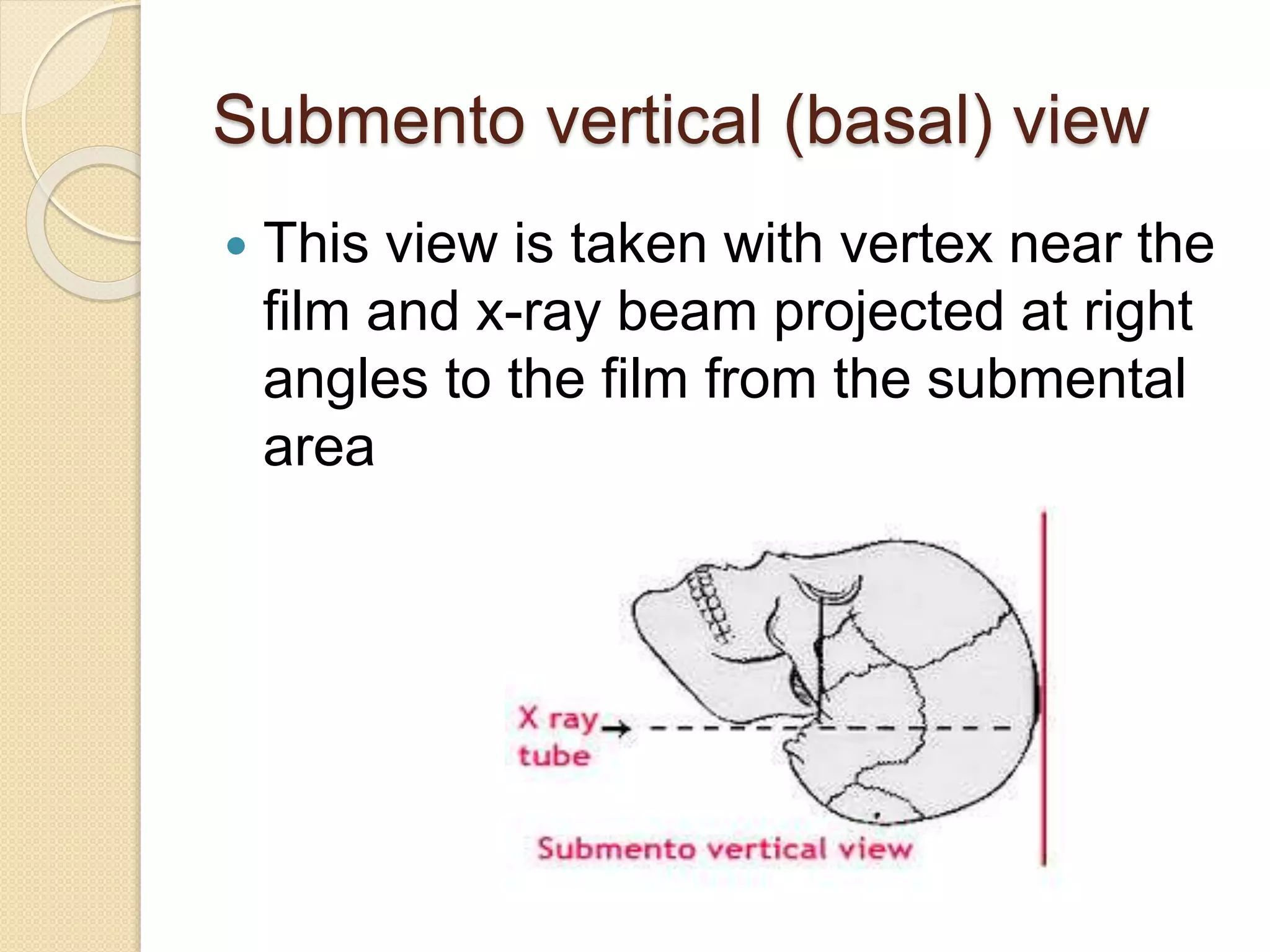 Radiology of nose and paranasal sinuses | PPTX