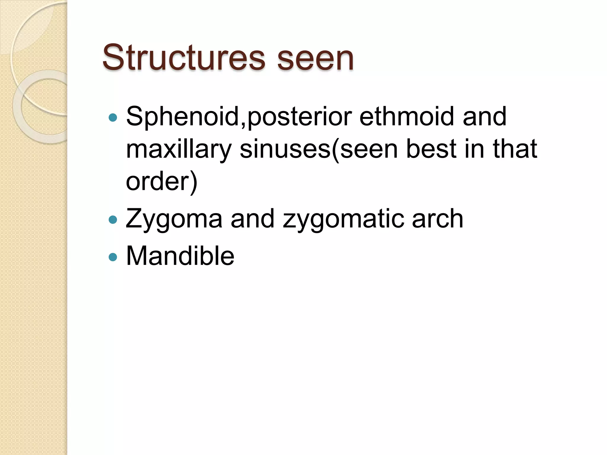 Radiology of nose and paranasal sinuses | PPTX
