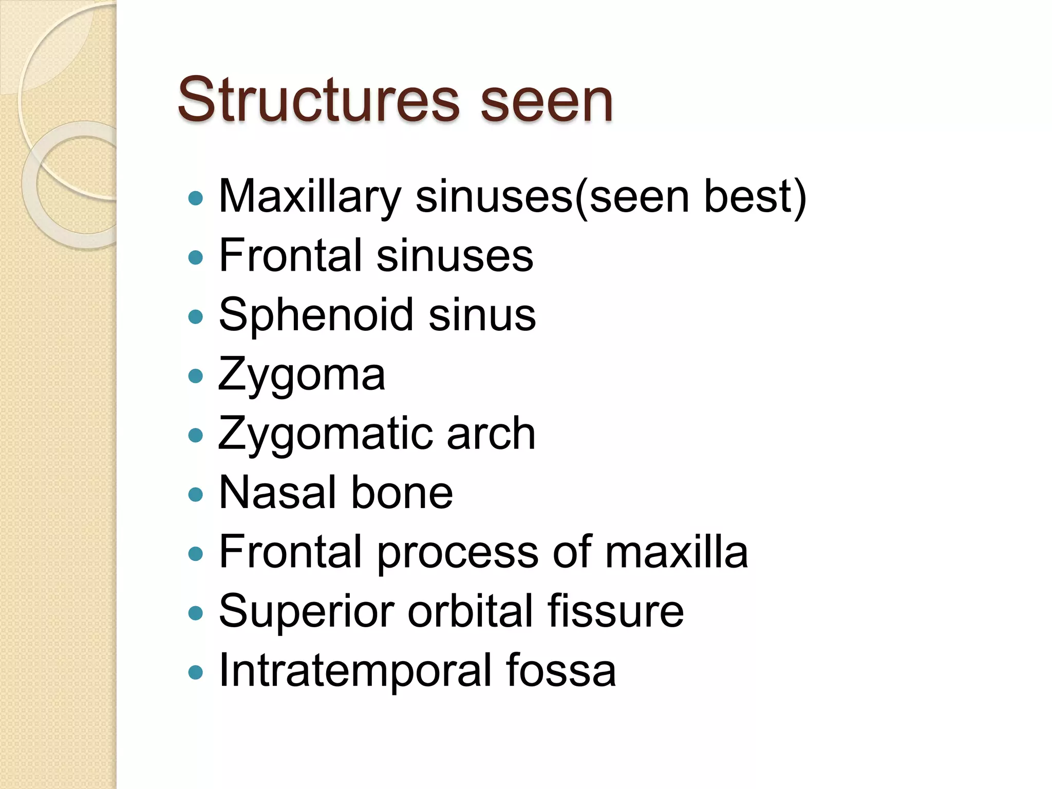 Radiology of nose and paranasal sinuses | PPTX