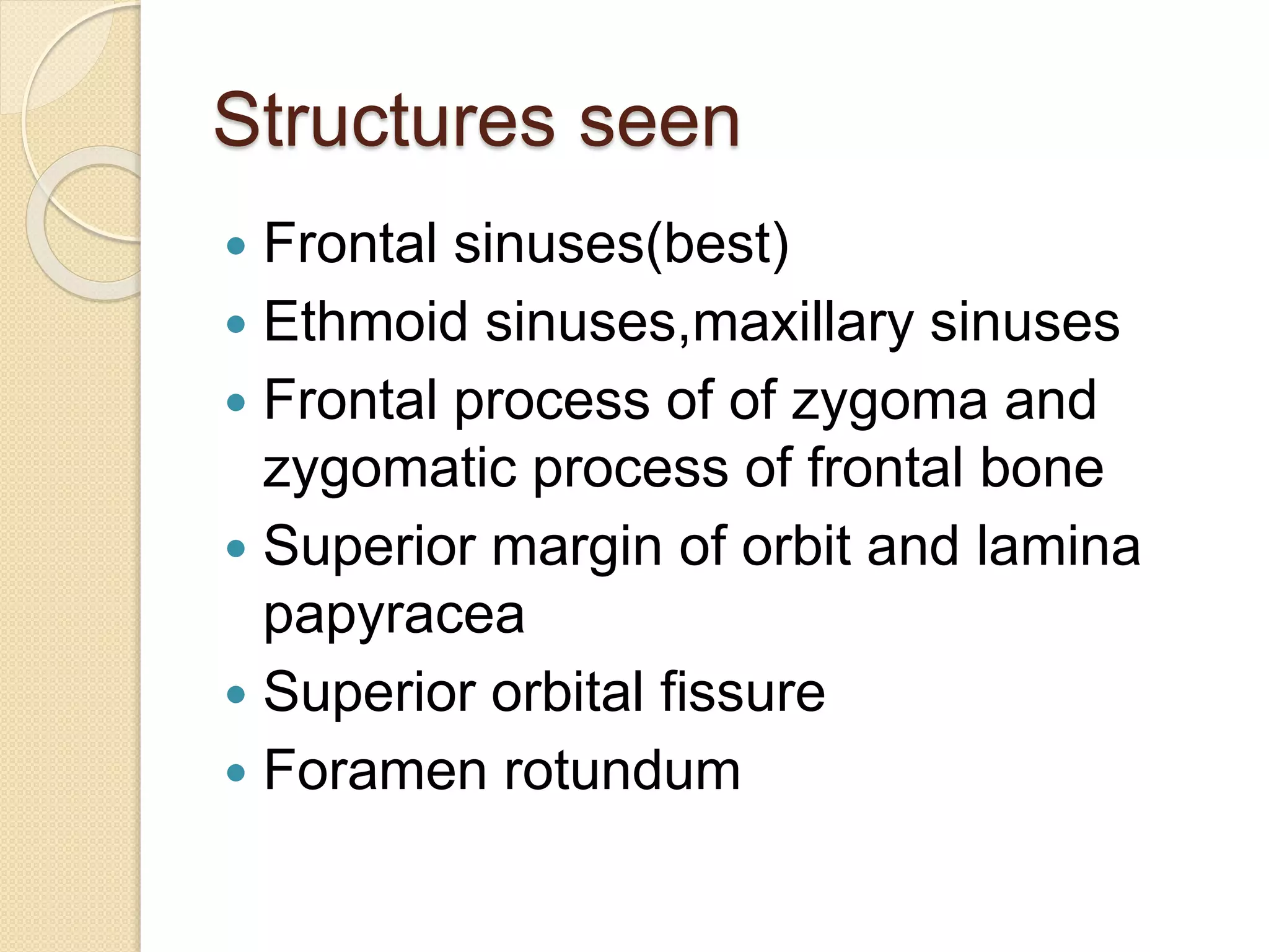 Radiology of nose and paranasal sinuses | PPTX