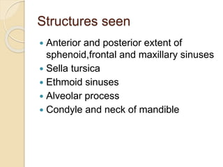 Radiology of nose and paranasal sinuses | PPTX