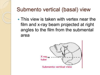 Radiology of nose and paranasal sinuses | PPTX