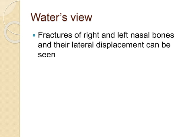 Radiology of nose and paranasal sinuses | PPTX