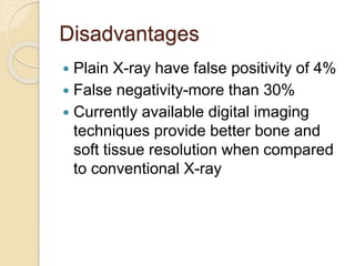Radiology of nose and paranasal sinuses | PPTX